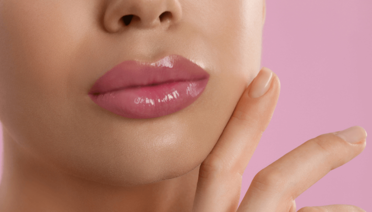 Lip Filler Swelling Stages: A Complete Guide - MySkyn Clinic