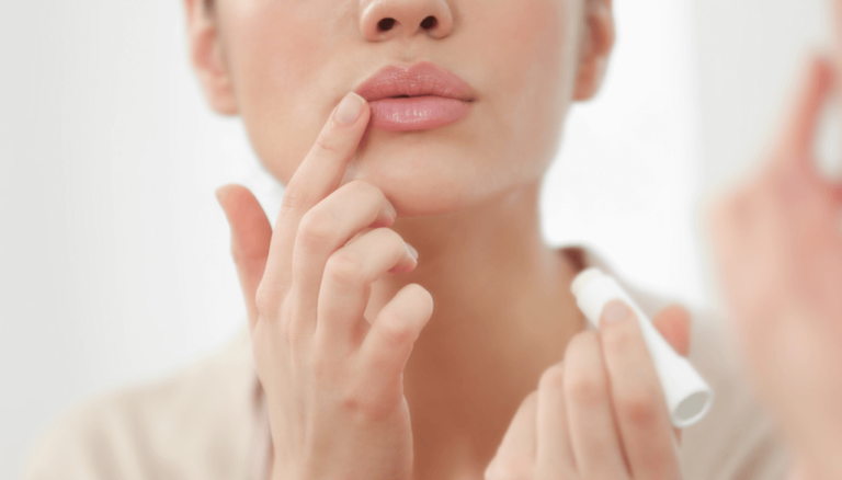 Lip Filler Aftercare: Dos and Don'ts for Best Results - MySkyn